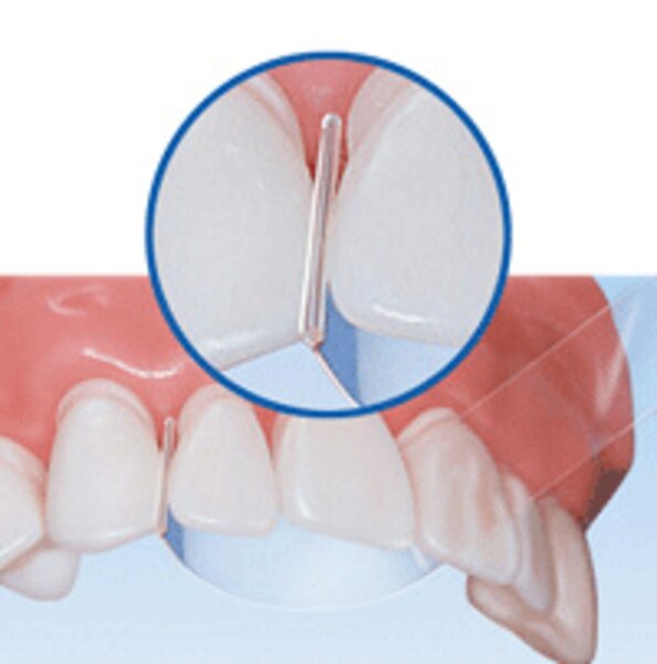 Stop Strip Matrix Band Straight 10mm Blue 100/Box | DC Dental
